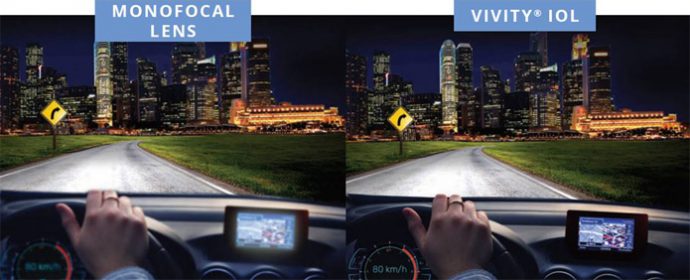 Eye Surgery Center of Michigan New Technology - Eye Surgery Center of ...